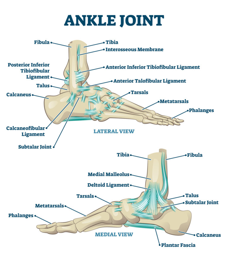Ankle Ligament Reconstruction: What You Need to Know - OrthoTexas